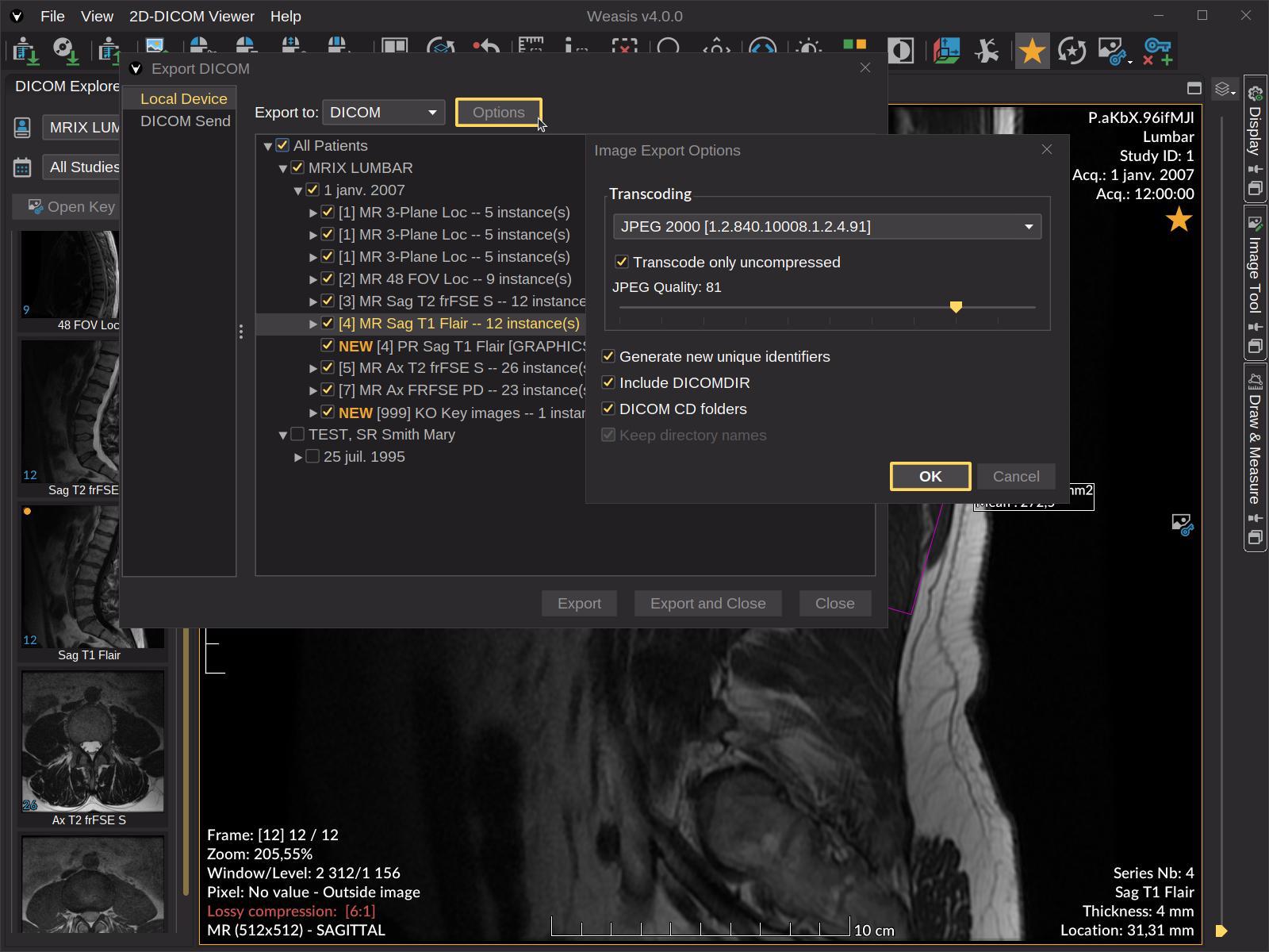Weasis: Free DICOM viewer :: Weasis Documentation